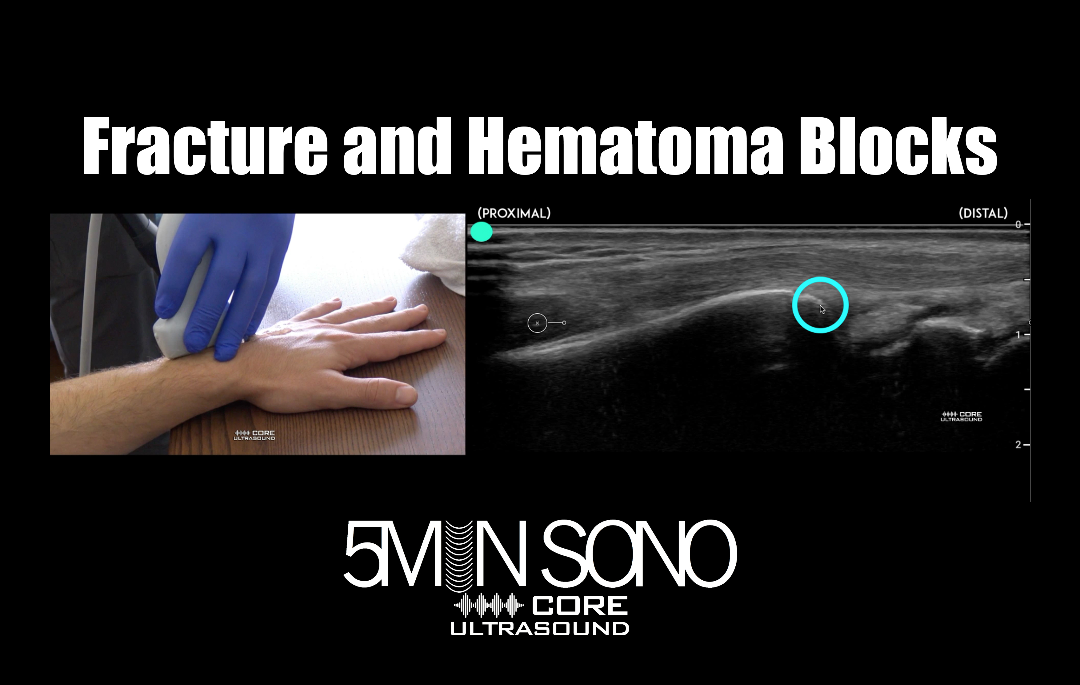 Find that fracture in seconds (and with no radiation!) AND perform that ...