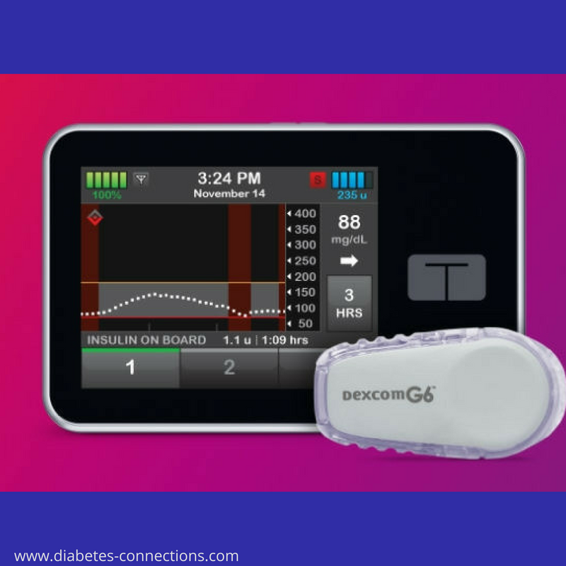 Basal IQ: Our First Days on Tandem's New Update – Diabetes Connections ...