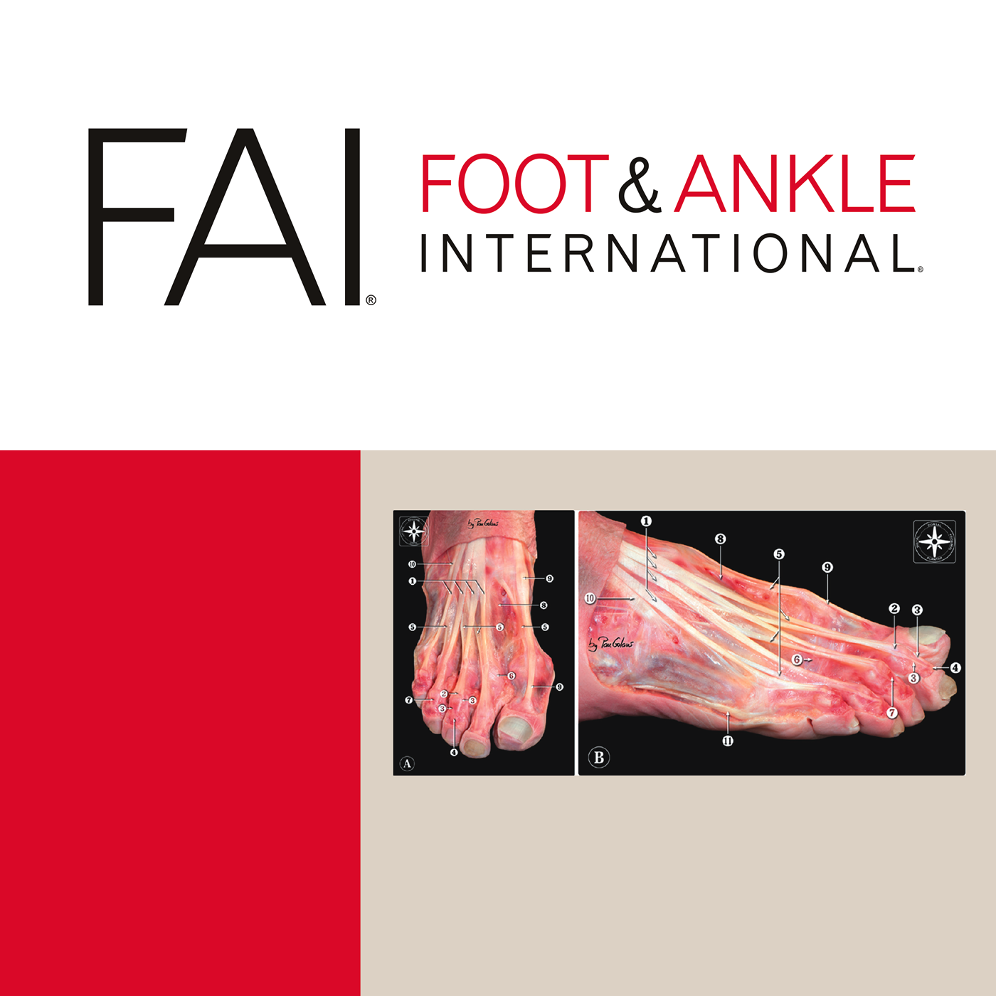 FAI May 2020: Mobility Limitation After Surgery for Degenerative ...